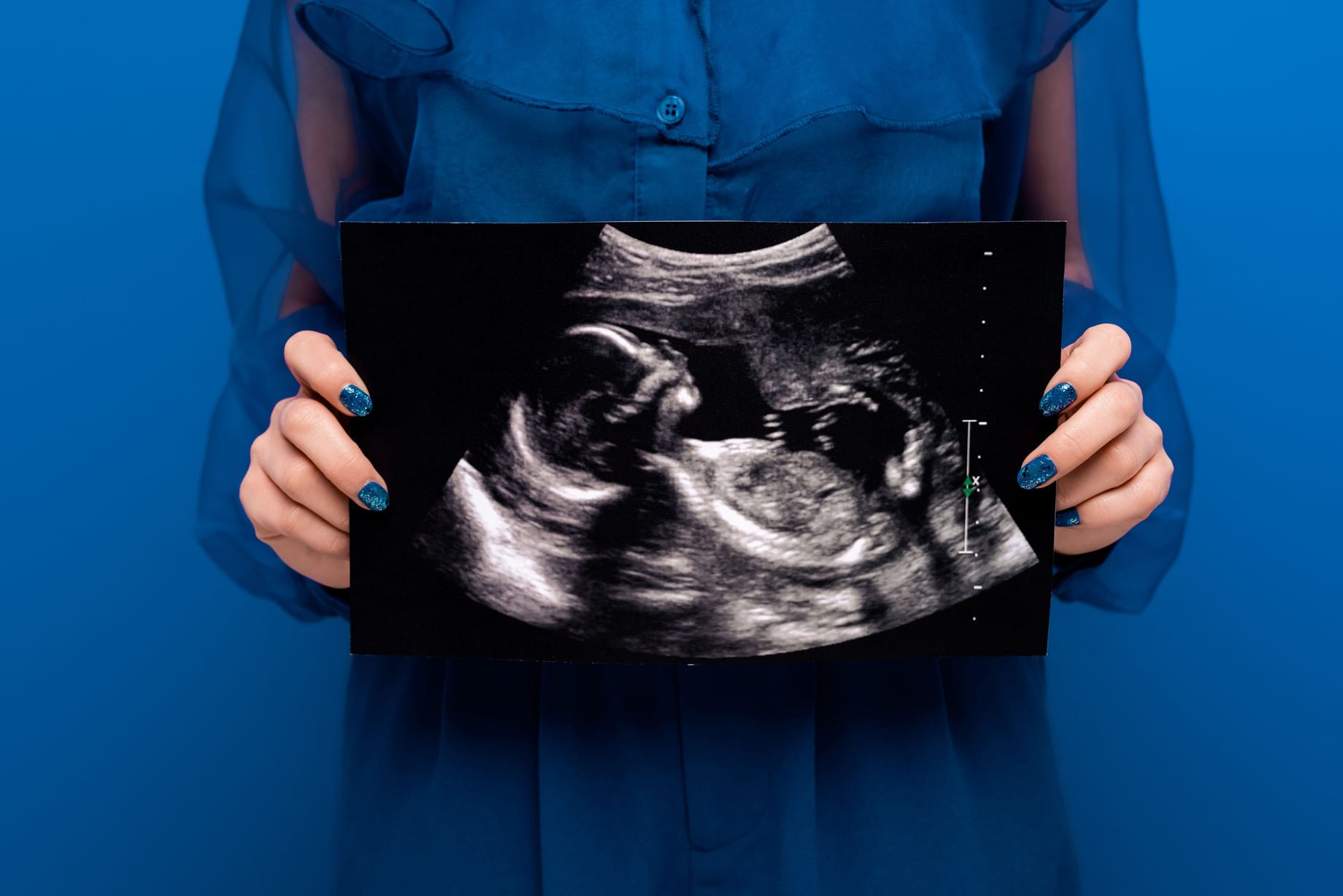 Tanda Jantina Anak Semasa Hamil – Anak Lelaki Atau Perempuan?